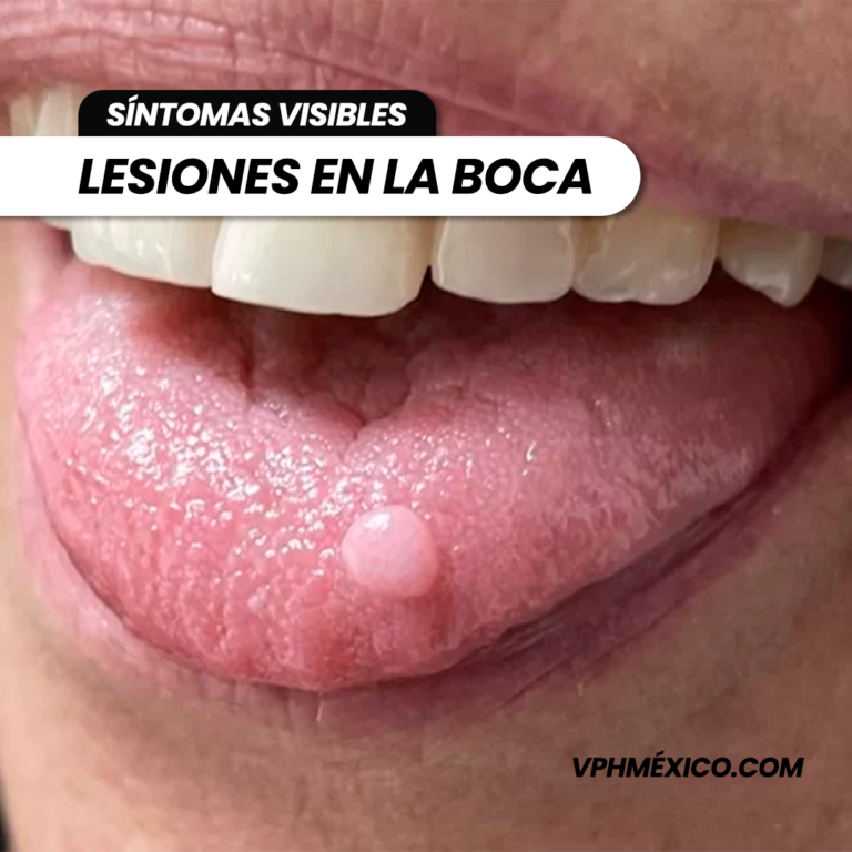 VPH en México: Síntomas, Prevención y Tratamiento - VPH EN MÉXICO